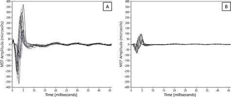 Example Of An Overlay Meps From Individual Without Lbp A And