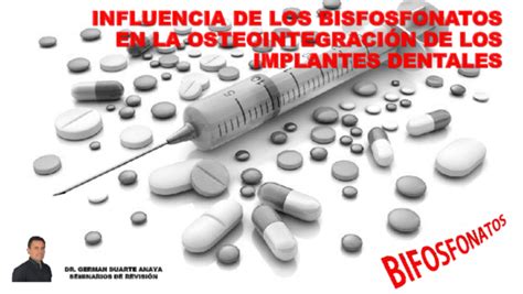 Pdf Influencia De Los Bisfosfonatos En La OsteointegraciÓn 22 Nov