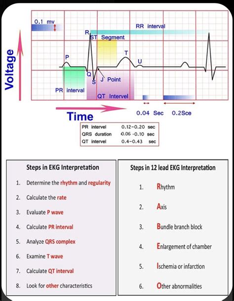 How To Read An Electrocardiogram Ekg Ecg Artofit