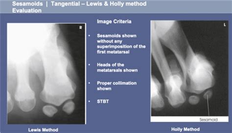 Radt 134 Lower Extremities Image Criteria Flashcards Quizlet