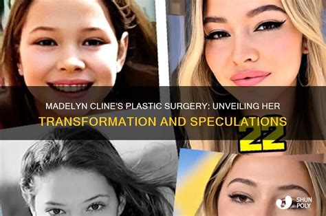 Madelyn Clines Plastic Surgery Unveiling Her Transformation And