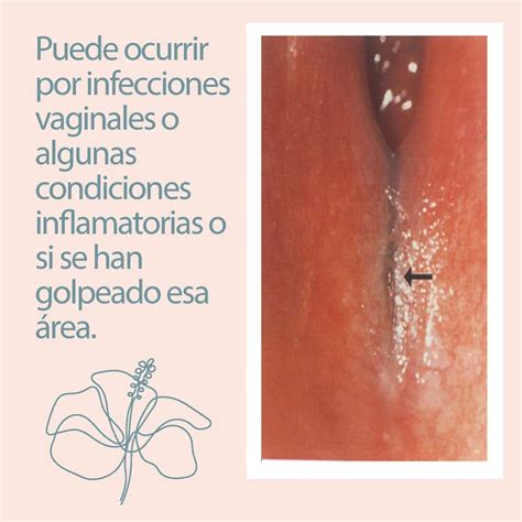 Stephanie Lezcano David