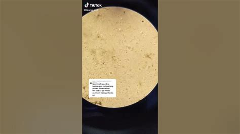 Sperm Cell Under Miscroscope Youtube