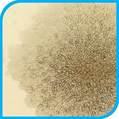 Organismofthemonth Tuberculosis Microbiology Bccm Belgian