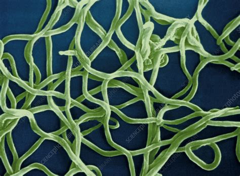 Lyme Disease Borrelia Burgdorferi Stock Image B220 1506 Science