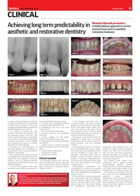 Dahl Approach A Novel Technique To Raise Bite Pptx
