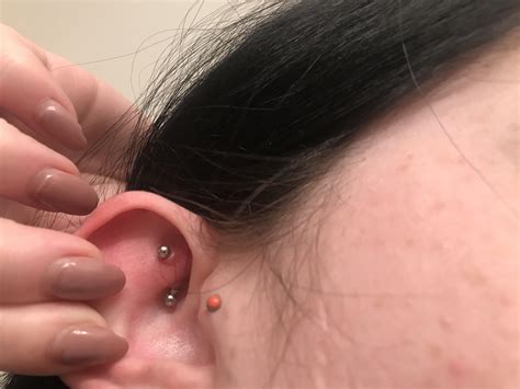 2 Month Old Rook Has This Bump I Follow Litha No Touching And Very