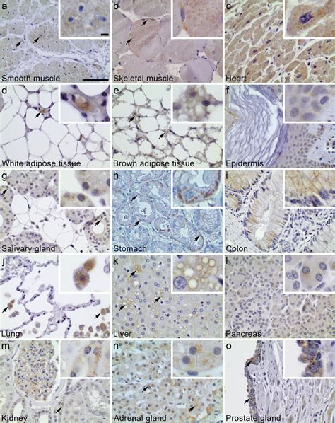 Subcellular Localization Of Perilipin 5 At Small Lds In Human Tissues
