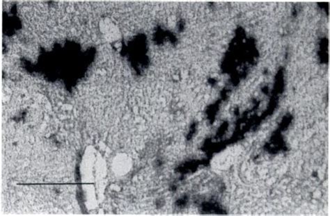 Unstained Autoradiograms Of Chimeric Rat Liver Chimeras Were Produced Download Scientific