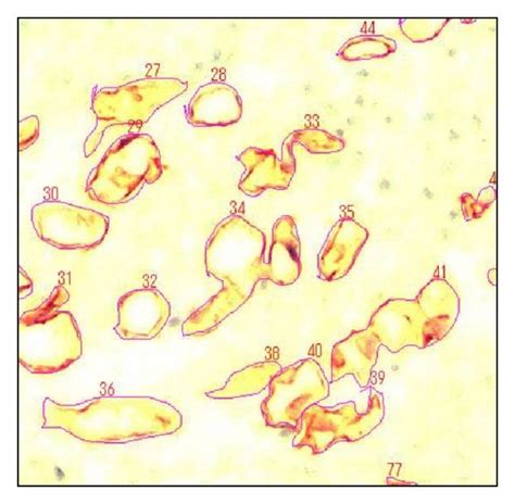 Determination Of Microvascular Density And Vascular Architecture A B