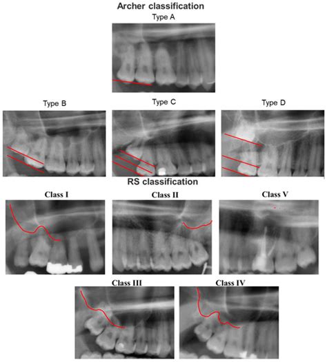 Performance Analysis Of Supervised Machine Learning Algorithms For