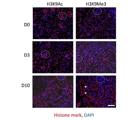 Immunofluorescent Staining Of H3k9 Acetylation H3k9ac And