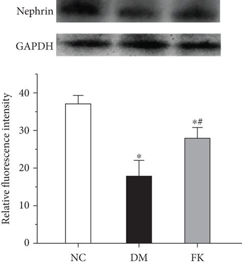 Podocyte Specific Nephrin Expressions Detected By Immunohistochemistry