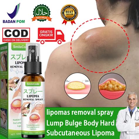 Lipoma Removal Cream Original 50ml Lymphoma Removal Treat Tumor Skin Swelling Ointment Lipoma