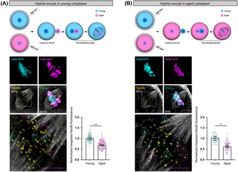 Kinetochore Deterioration Concommitant With Centromere Weakening During Aging In Mouse Oocyte