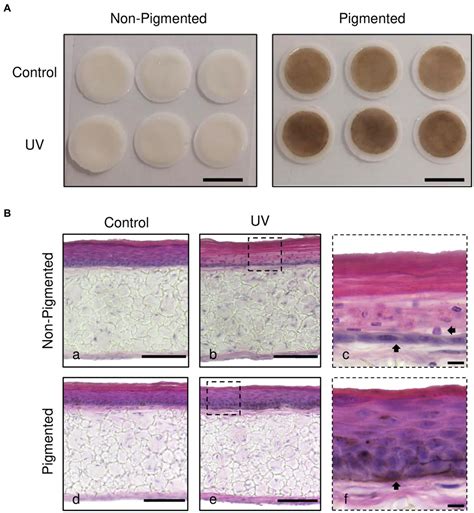 Frontiers Comparison Of Photodamage In Non Pigmented And Pigmented