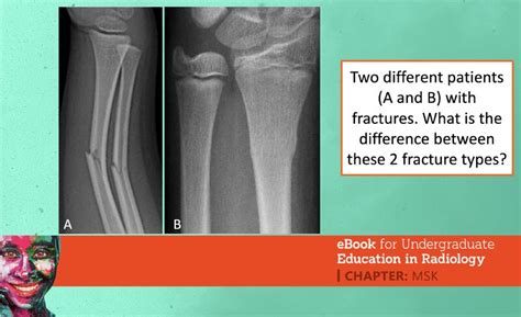 Radiology Student Interest Group Radsig On Linkedin What An Amazing