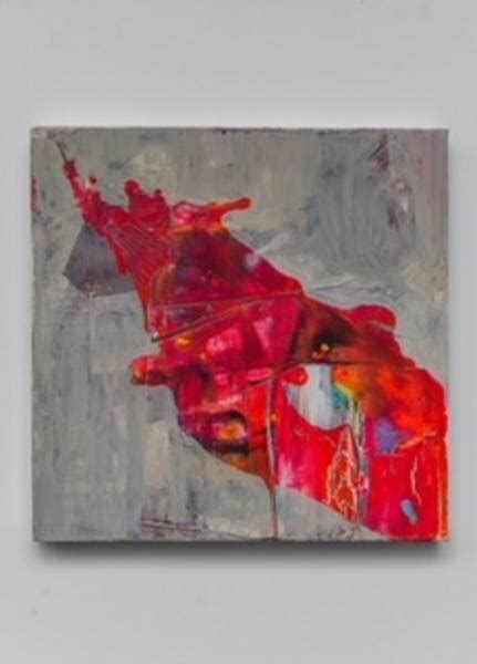 Brücher Ukm Augenklinik