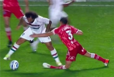 Video Escalofriante Lesión De Un Jugador De Argentinos Por Una