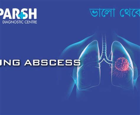 Pleural Infection Empyema Causes Symptoms Diagnosis And Treatment Sparsh Diagnostic Center