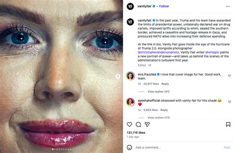 Karoline Leavitts Vanity Fair Close Up Photo Triggers Viral Lip Filler