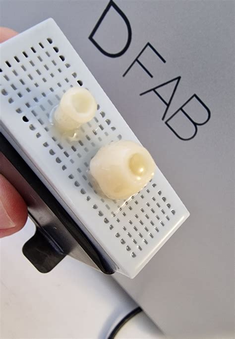 Implant Restoration Through A Full Digital Additive Chairside Workflow