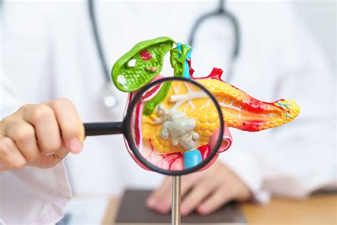 Apoya En El Día Mundial Del Cáncer De Páncreas A Las Personas Que