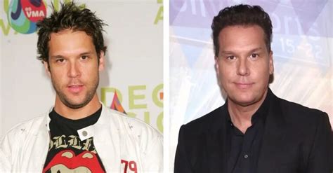 Dane Cook Plastic Surgery With Before And After Photos