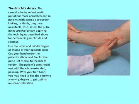 Brachial Artery Cpne Brachial Carotid Artery Arteries