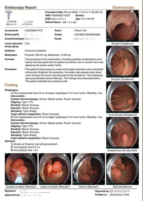 6 Best Practices For Choosing The Right Endoscopy Reporting Template