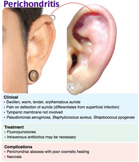 Staph Infection Outer Ear