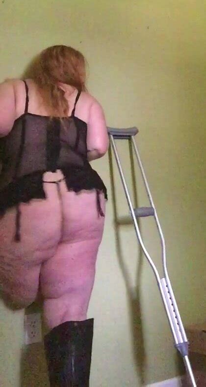 Fat Amputee Women