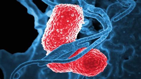 Study Shows How Pneumonia Causing Bacteria Invade The Body Infection