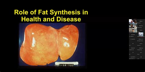 代谢与疾病”论坛系列讲座第七讲顺利举行