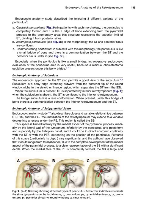 Endoscopic Anatomy Of Retrotympanum Middle Ear Pdf