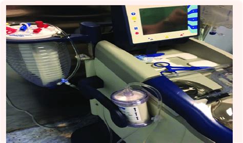 Surgical Recovery Blood Device With Sited Cytosorb Download