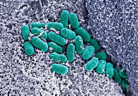 Ehec Bacteria On Human Colon Tissue Sem Stock Image C0325381 Science Photo Library