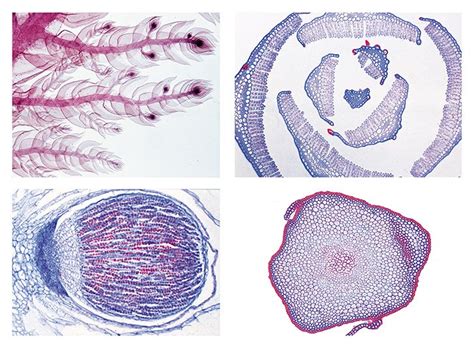 Liverworts And Mosses Slide Set