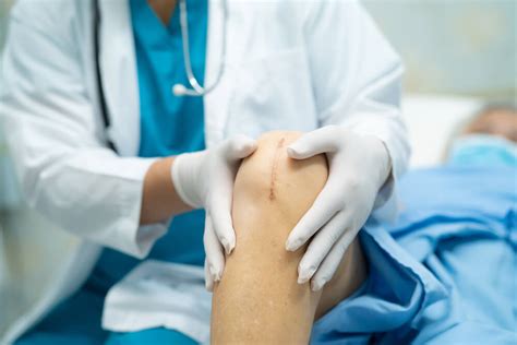 Your Guide To Exercises After Knee Replacement Surgery Integrity Physio