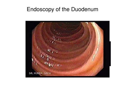 Ppt Gastrointestinal Motility Powerpoint Presentation Id4535732
