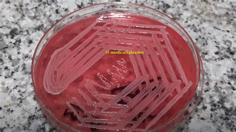 Staphylococcus Sciuri Introduction Morphology Pathogenicity