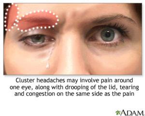 What Causes Eye Brow Pain Mata Clinic And Optometrist Blog