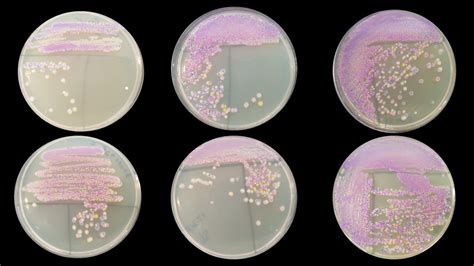 Bacterial Streak Plate