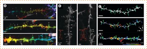 Full Article Three Dimensional Visualization And Analysis Of Dendritic
