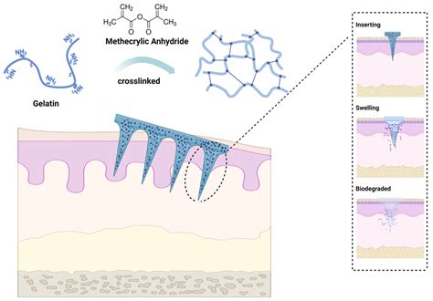 Hydrogel Forming Microneedles Encyclopedia Mdpi