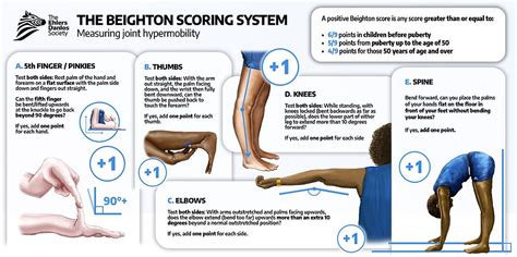 Joint Hypermobility Understanding The Different Types Of Hypermobility