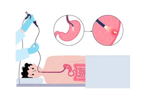 Premium Vector Gastroscopy Procedure Stomach Polyps Diagnostic Gastroenterologist Uses A