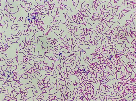 Premium Photo Microscopic View Of Gram Stain Showing Rod Shape Escherichia Coli Or E Coli