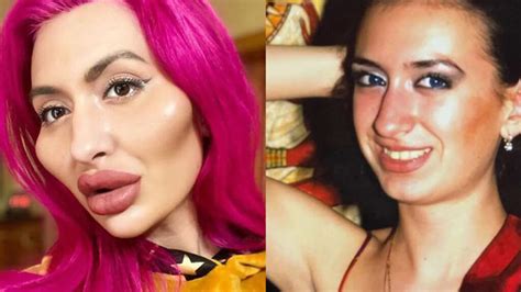 La Modella Con Le Guance Più Grandi Al Mondo Ora Voglio Cuo E Tette