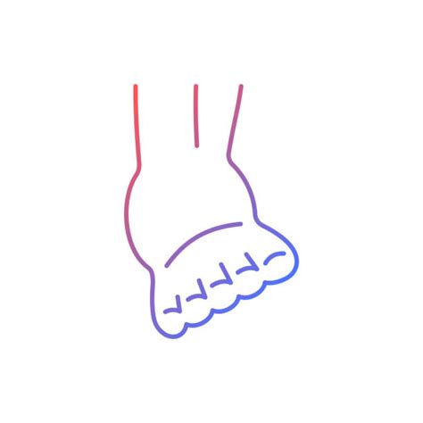 40 Ankle Sprains Drawing Stock Illustrations Royalty Free Vector